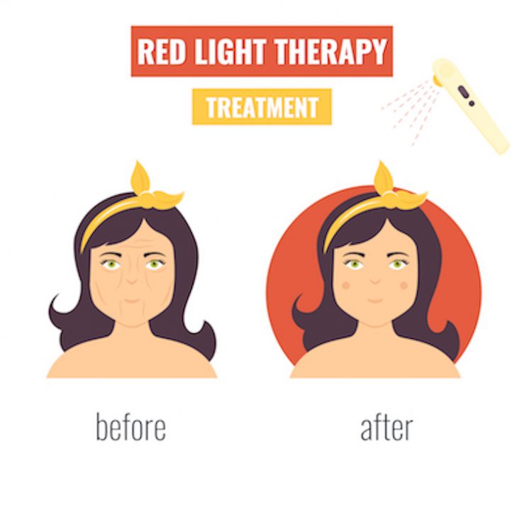Red Light Therapy: The Definitive Guide – Mom Prepares